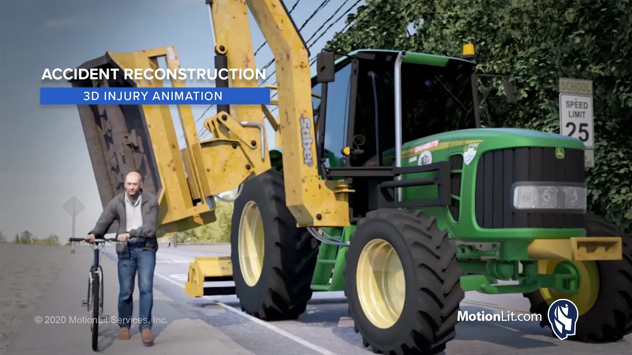 3D Accident Animation Portrays Tentorial Subdural Brain Hemorrhage - MotionLit