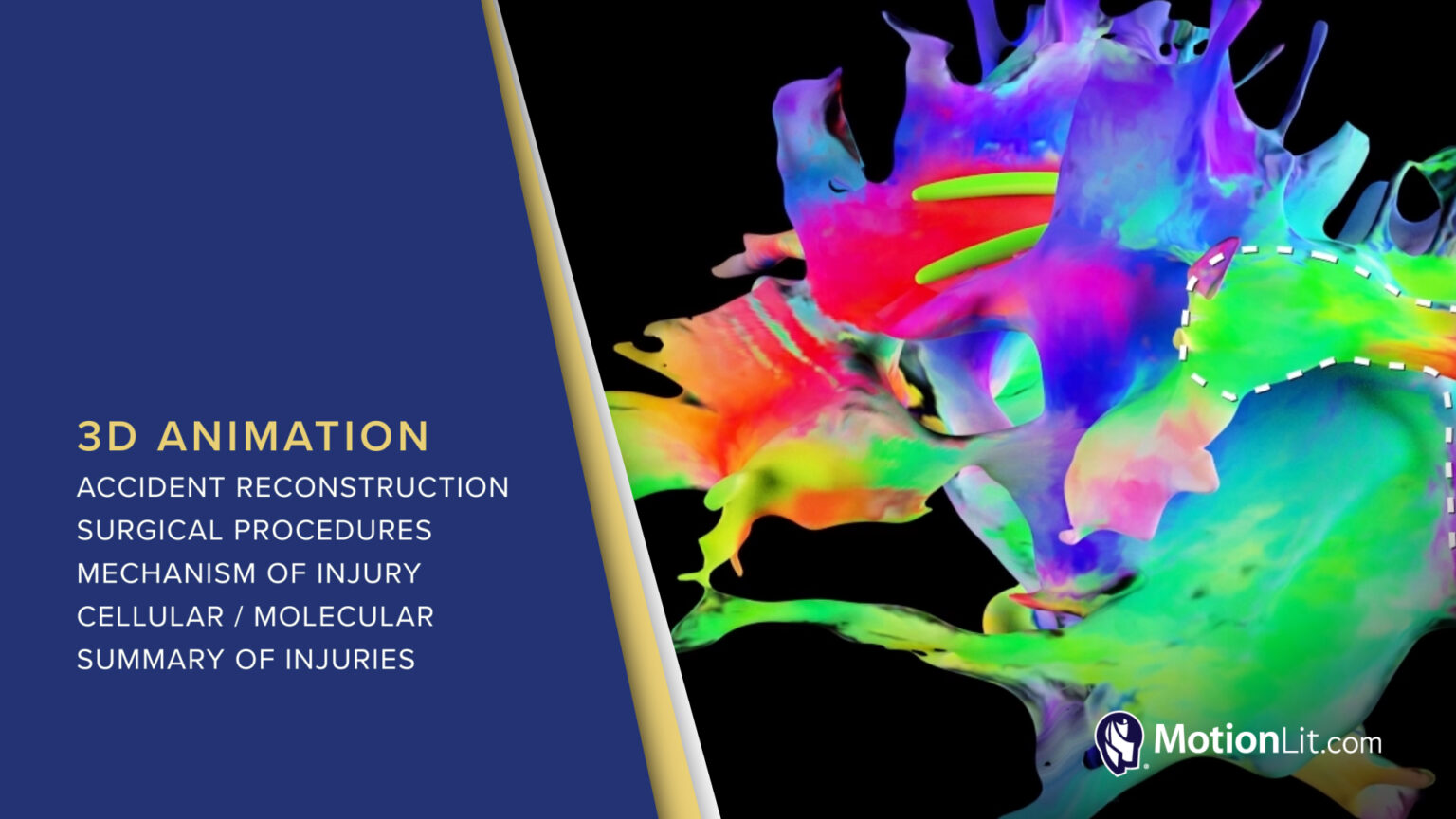 Medical Procedure Animation Visualizes Posterior Lumbar Microdiscectomy ...